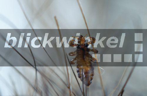 blickwinkel - Kopflaus, Kopf-Laus (Pediculus capitis, Pediculus humanus ...