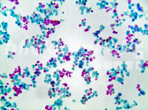 blickwinkel - Hefezellen, 1000-fach - yeast cells, 1000 x - fotototo