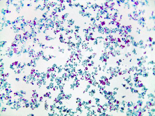 blickwinkel - Hefezellen, 400-fach - yeast cells, 400 x - fotototo